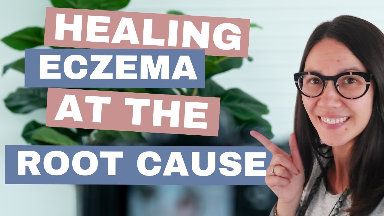 HEALING ECZEMA at the Root Cause | Dr Melissa Raymond, PhD - YouTube