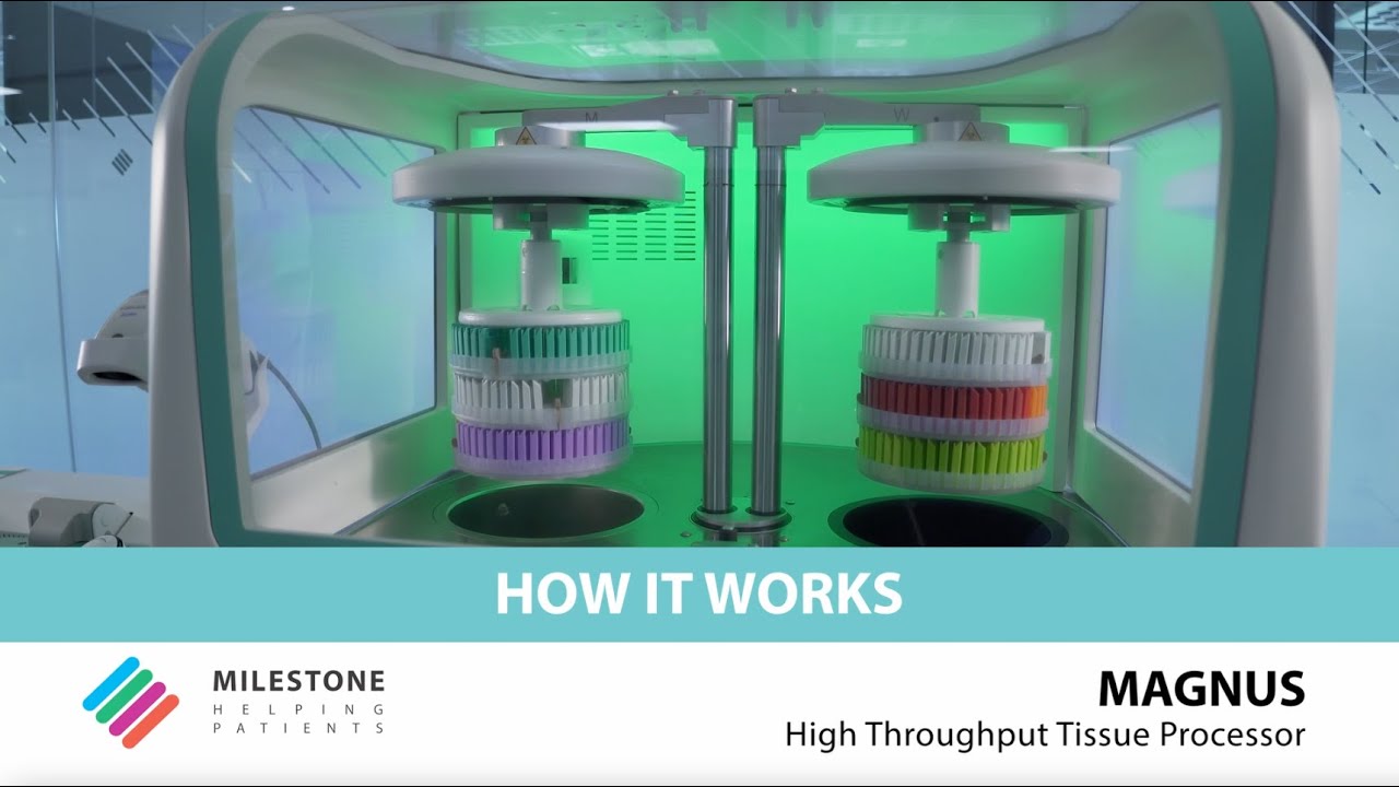 MAGNUS High Throughput Tissue Processor – How it works - YouTube