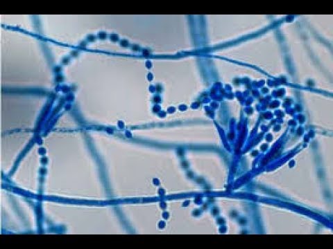 Paecilomyces colony morphology on CMA and LPCB tease mount Microscopy ...