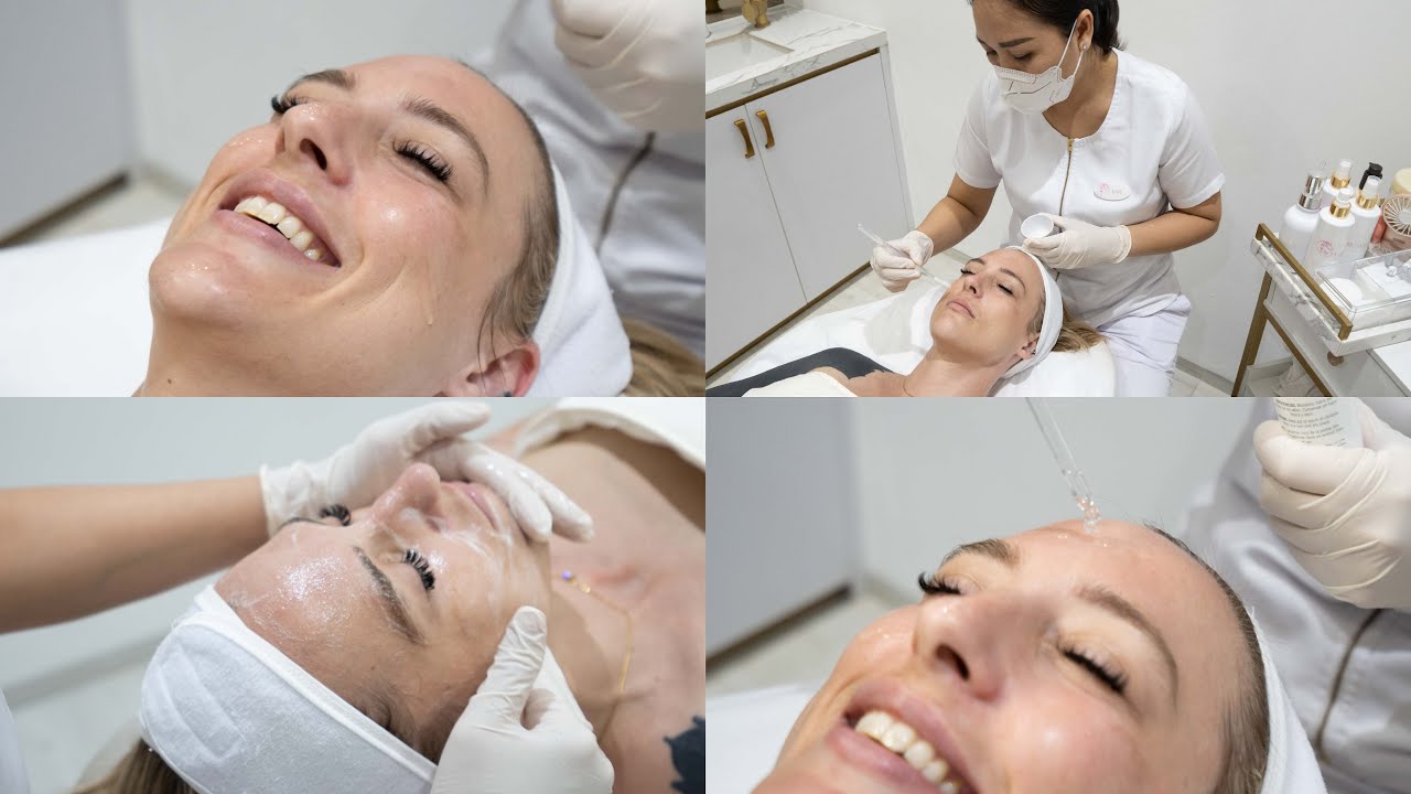 MeLine Melasma Peel🤍 - YouTube