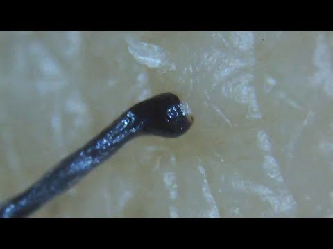 Beard Plucking : Microscope Art File(242) - YouTube