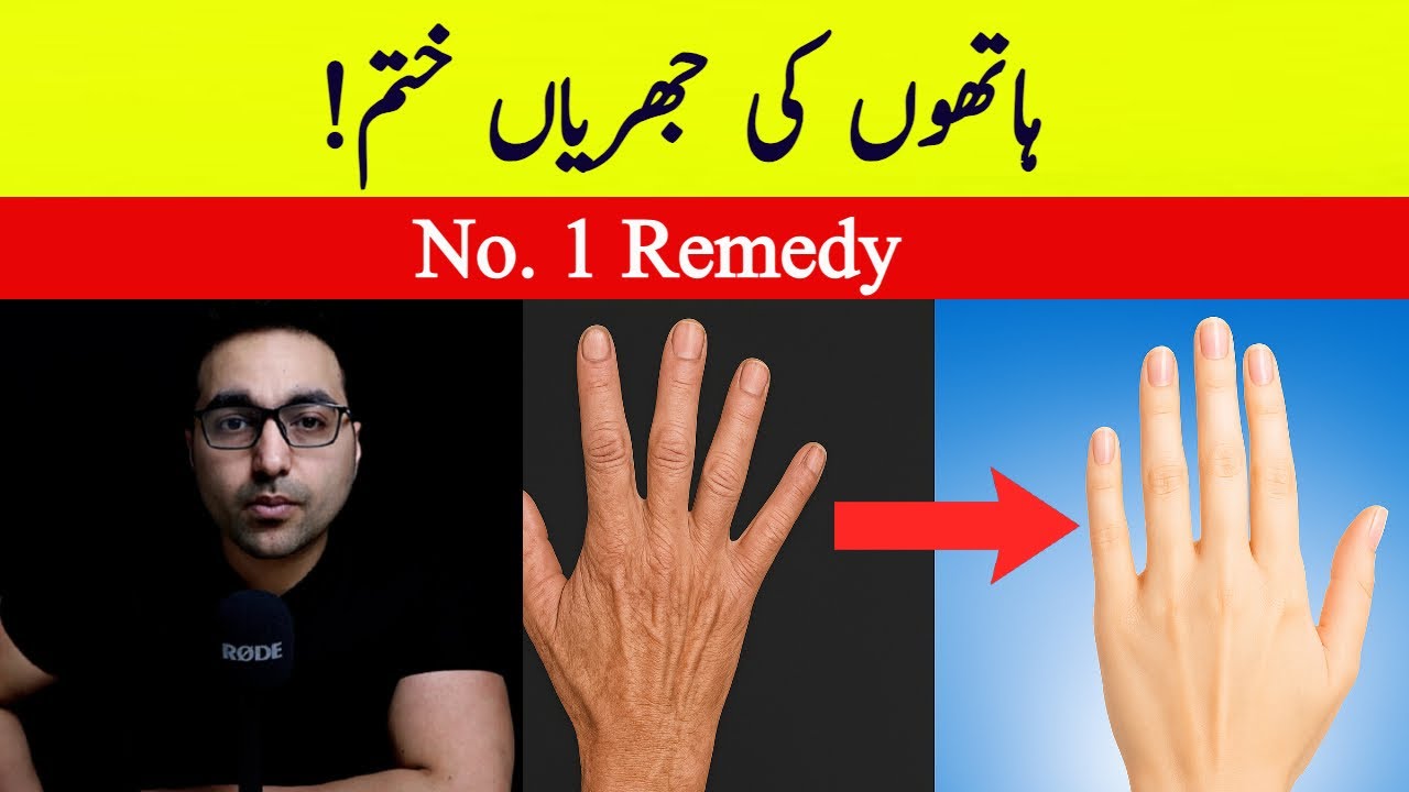 Dr. Zee:#1 Absolute Best Remedy for Dry and Wrinkled Hands उत्तम उपाय ...