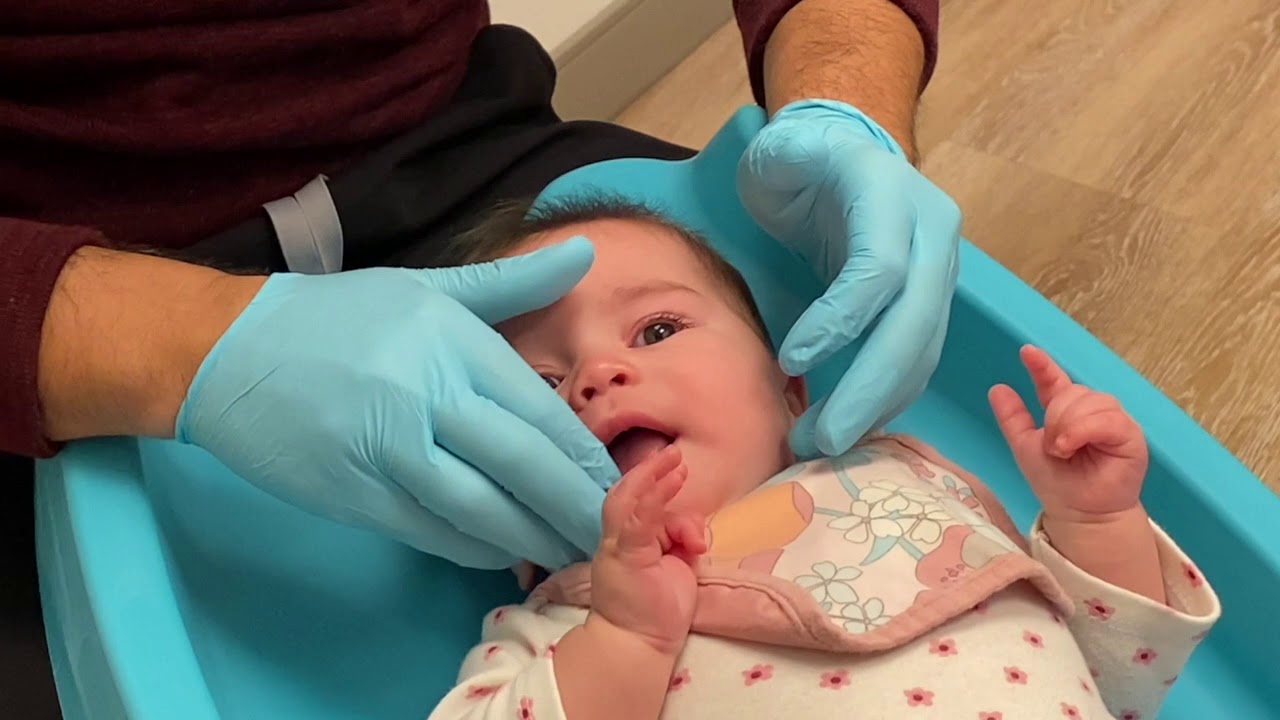 Frenectomy Exercises - YouTube