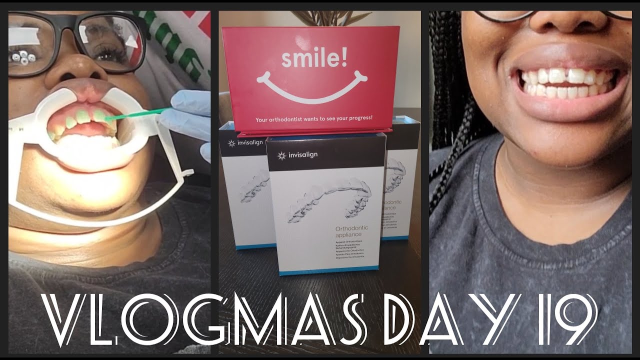 Vlogmas Day 19 | Invisalign Journey | Overbite | Gaps - YouTube