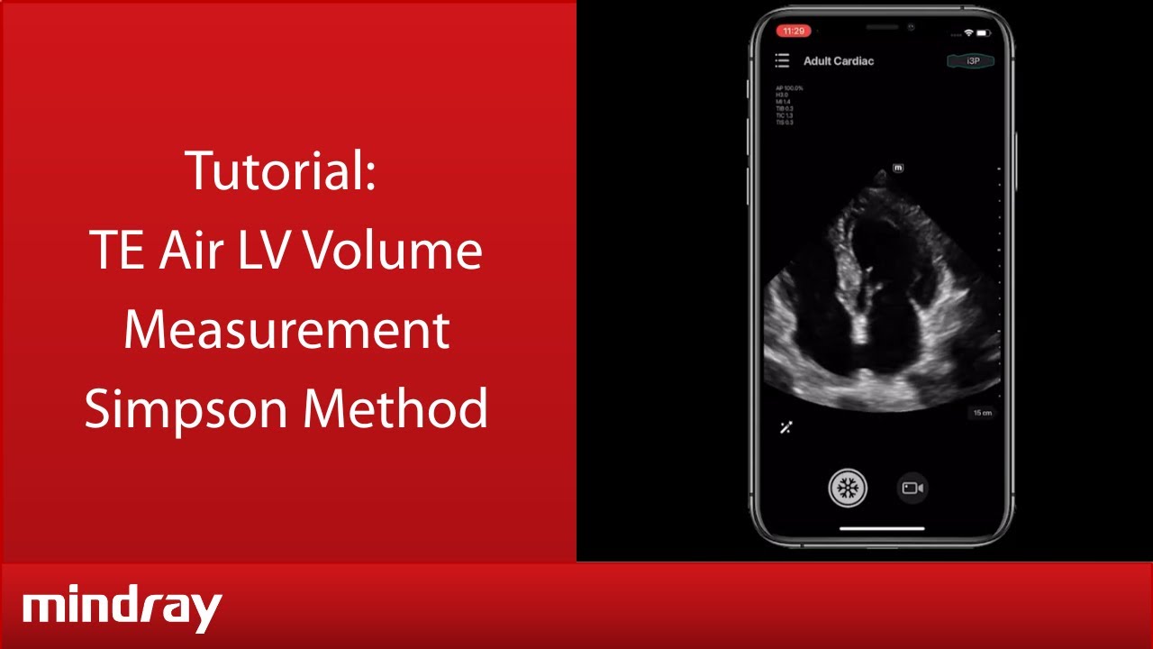 Mindray TE Air Tutorial - LV Volume Measurement Simpson Method - YouTube