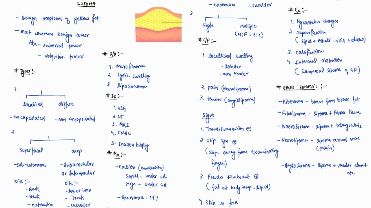 LIPOMA NOTES | GENERAL SURGERY | ONE PAGE NOTES | 4TH PROFF | MBBS ...