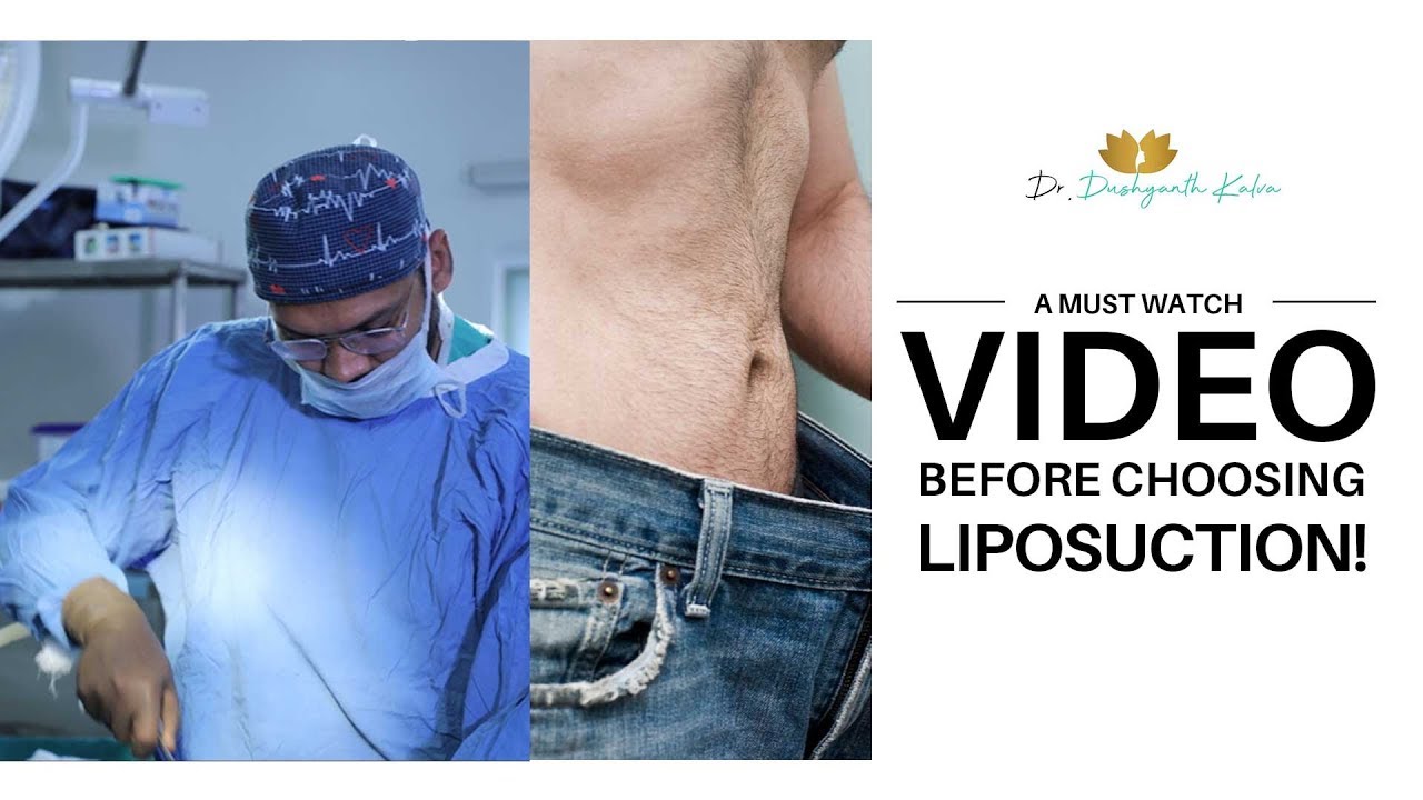Everything you need to know about Liposuction! - YouTube