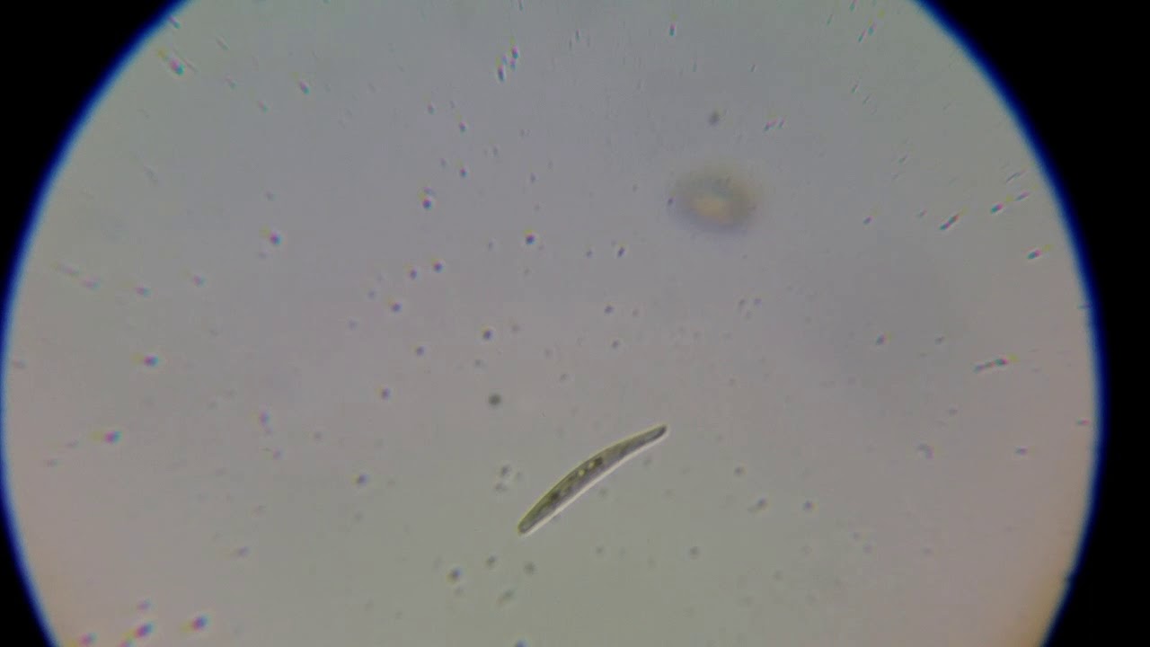Microscopio - Protozoo ciliato - YouTube