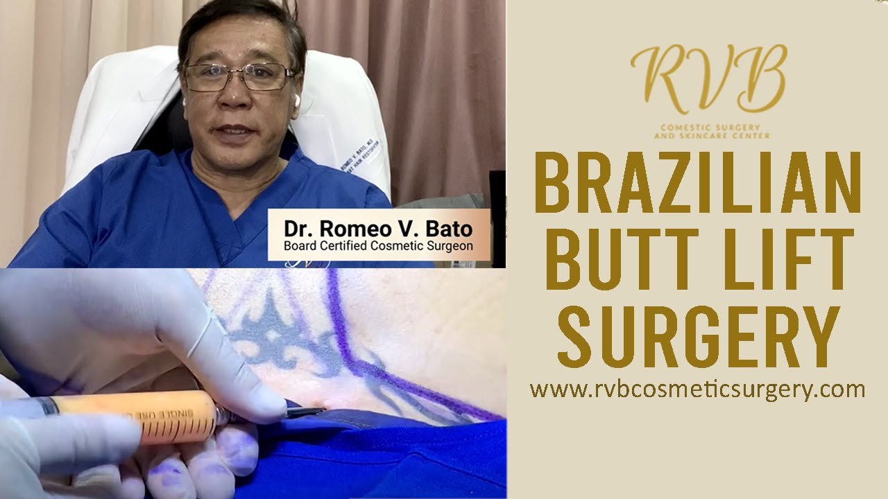 Brazilian Butt Lift (BBL) Procedure Performed by Dr. Romeo V. Bato ...