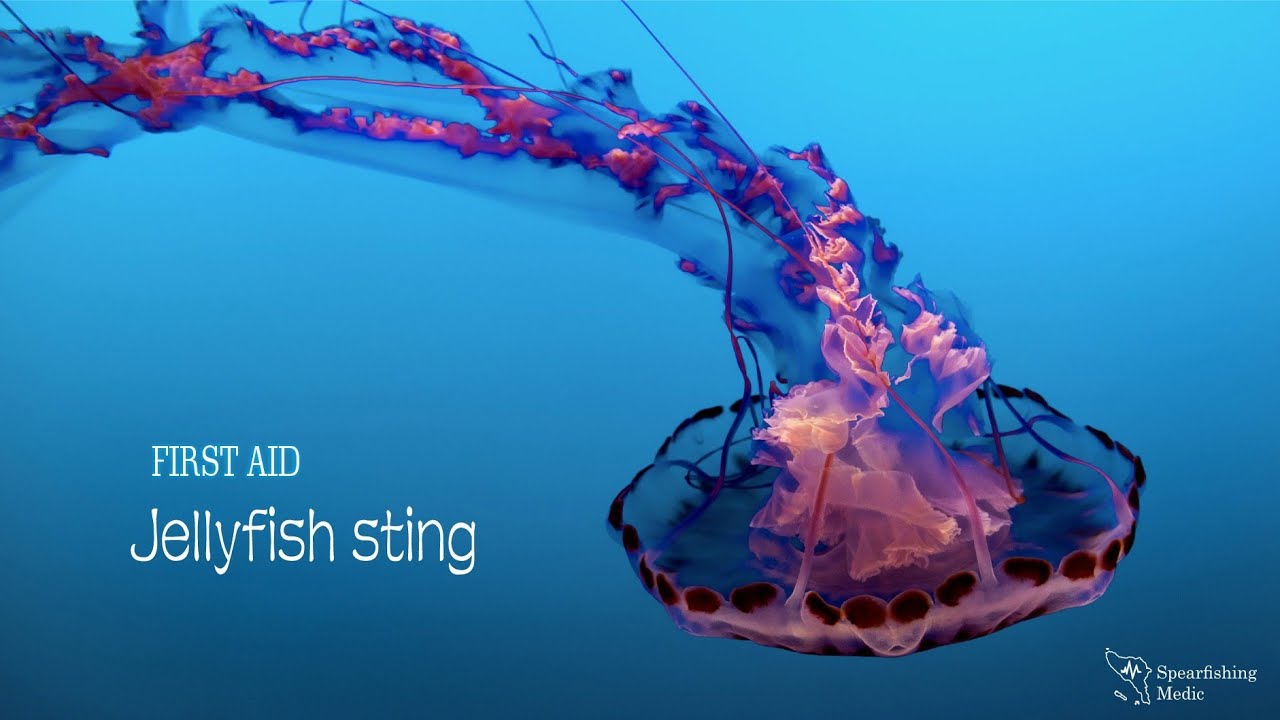 FIRST AID: INJURIES CAUSED BY JELLYFISH, PORTUGUESE MAN-OF-WAR, SEA ...