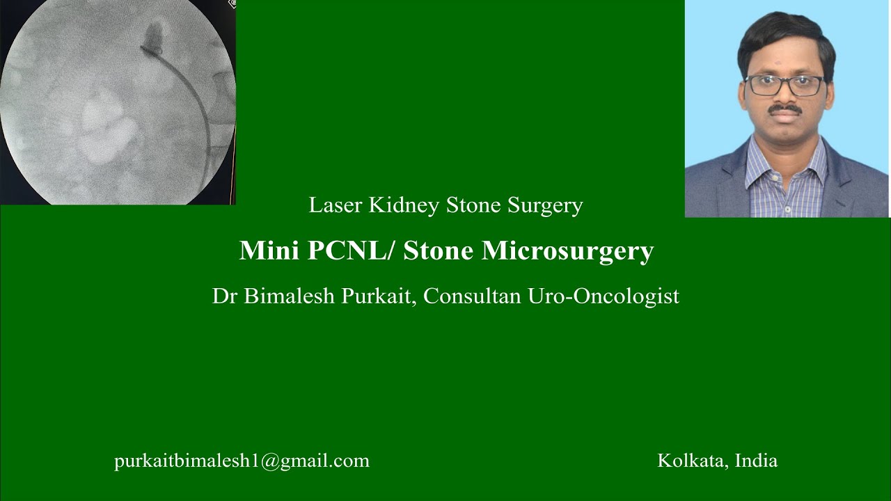 Dr Bimalesh Purkait: Laser Stone Surgery/ Kidney Stone Microsurgery ...