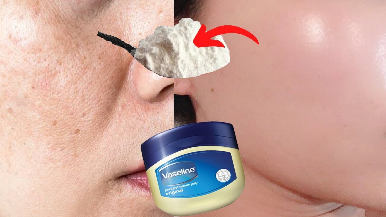Vaseline Is A Million Times Stronger Than Botox Eliminate Deep