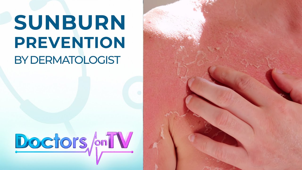 How to Prevent Sunburn explained by Dermatologist - YouTube