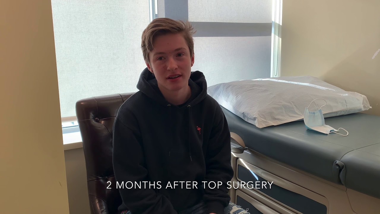 Keyhole top surgery - 2 months after surgery - YouTube