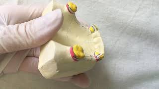 desenho de armação metálica de PPR modelo classe III | Doovi