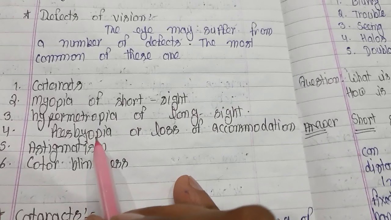 Class 10 human eye (English): defect of vision - YouTube