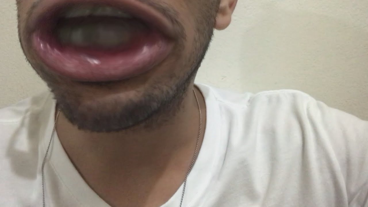ASMR + SONS DE BOCA INCRÍVEIS PRA APAGAR RÁPIDO - Asmr RELAXANTE - YouTube