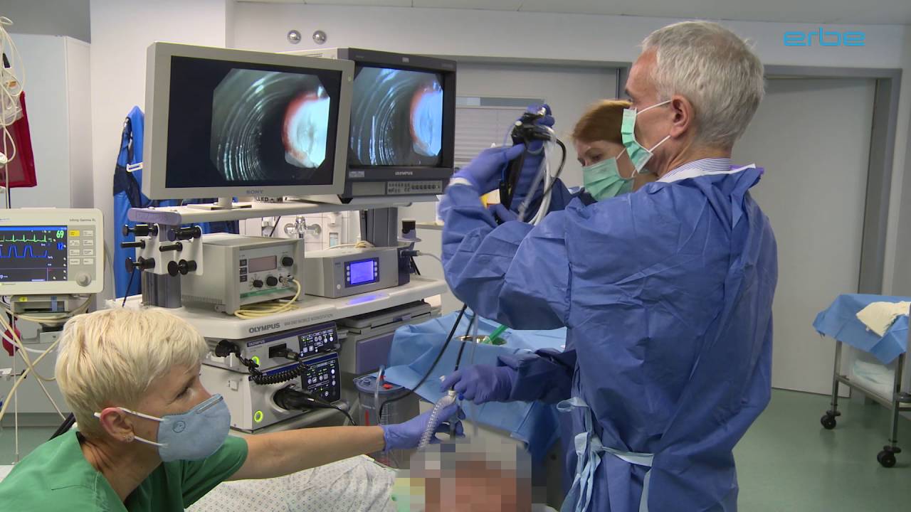 ErbeCryo2 - Cryobiopsie - YouTube