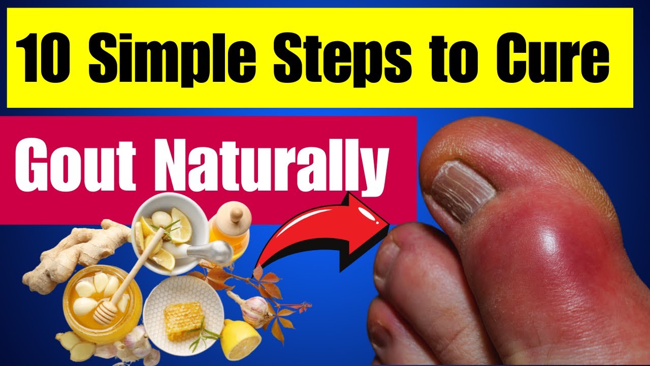 Natural Solutions Conquer Gout in 10 Simple Steps | How To Treat Gout ...