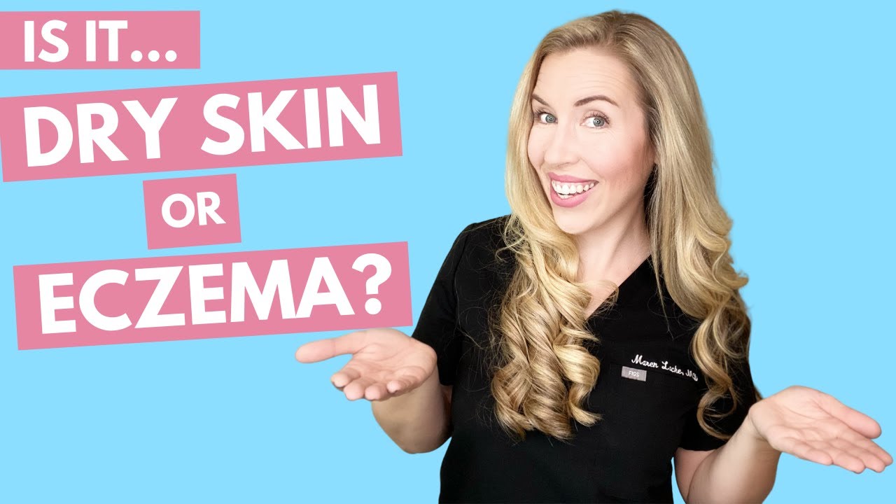 Is it Dry Skin or Eczema? | How to Treat With Affordable Product ...