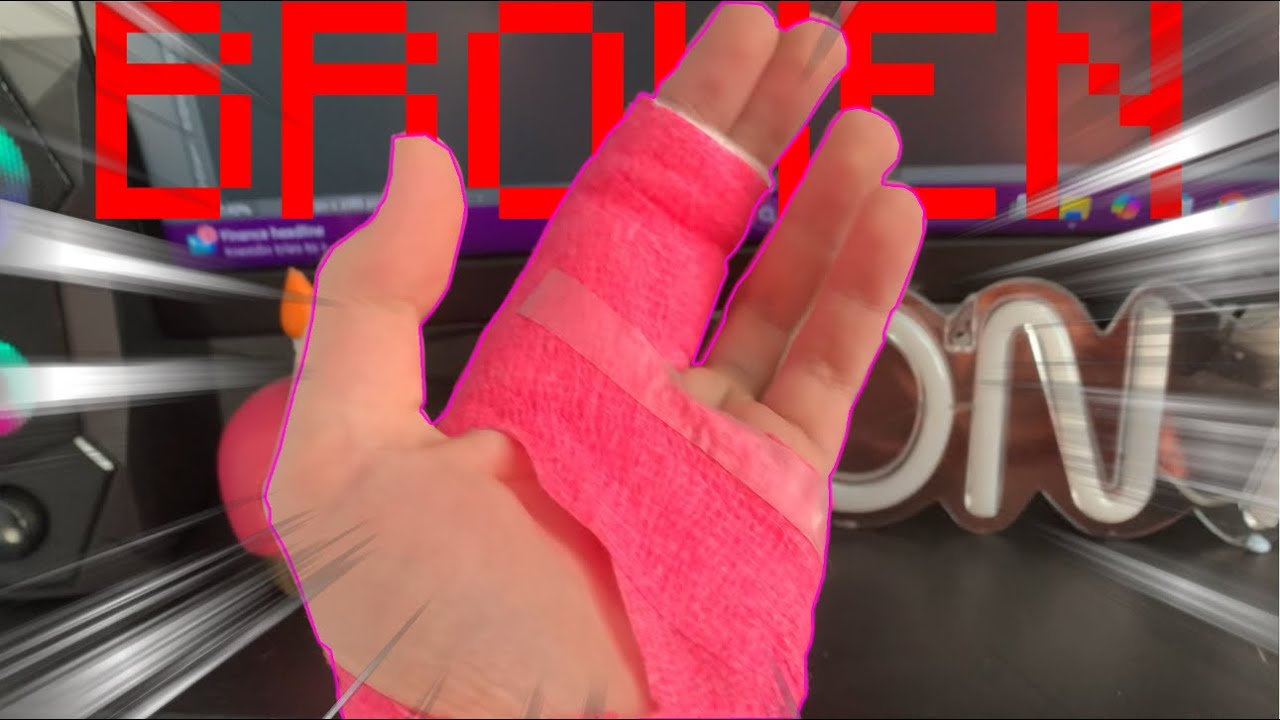 so.... I broke my finger.......... - YouTube