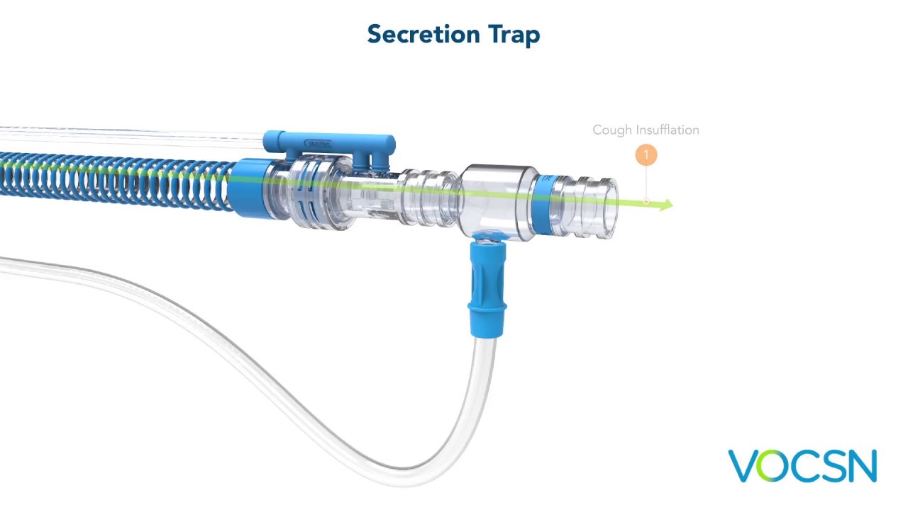 Ventec One-Circuit™ Secretion Trap - YouTube