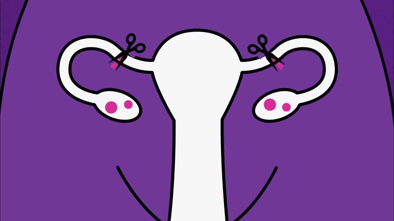 Brook Contraception Sterilisation Animation Youtube