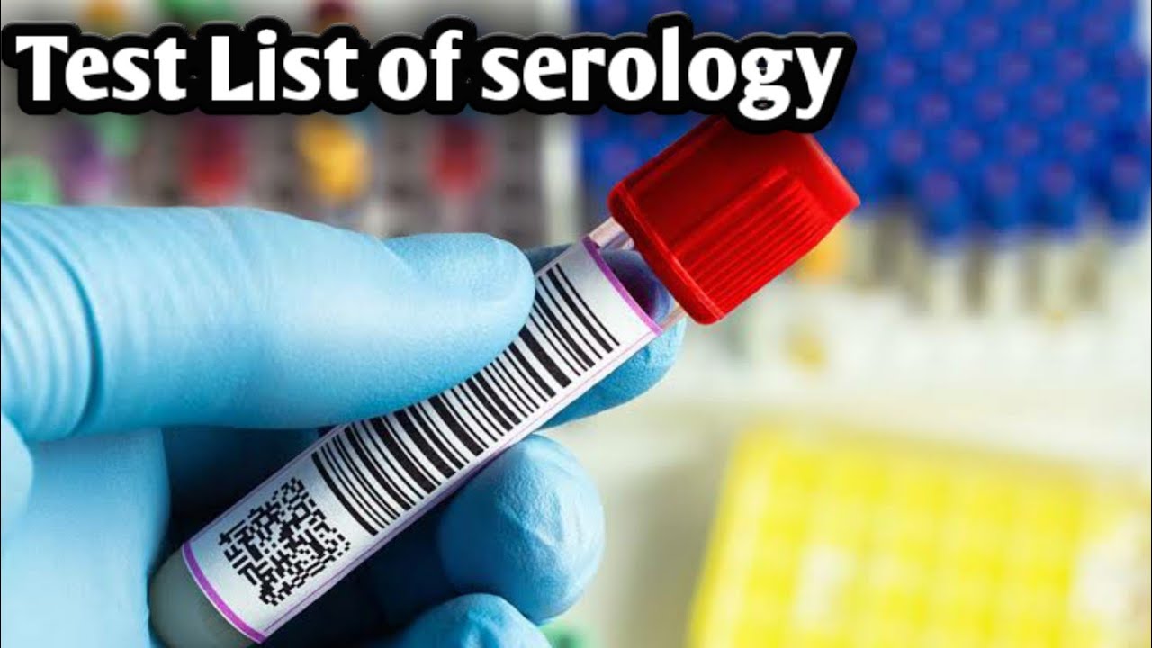 Serology test list: Tests in Serology department - YouTube