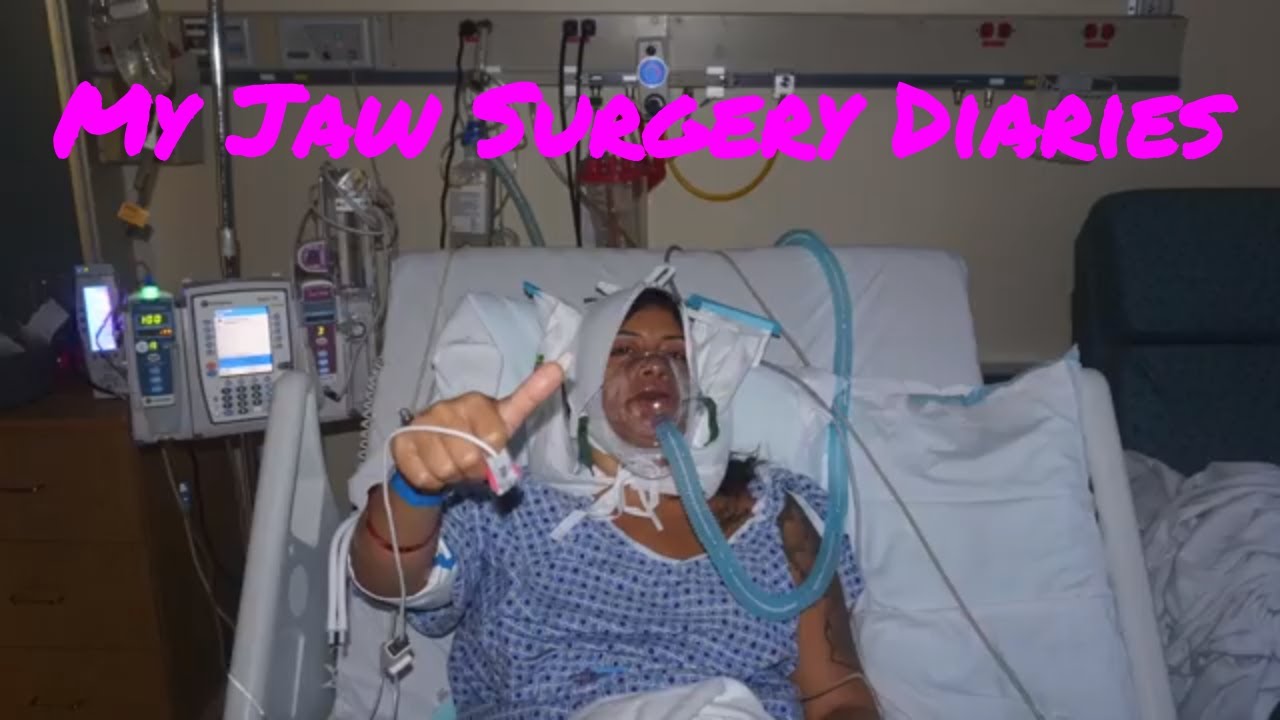 Jaw Surgery Vlog Before and After - YouTube