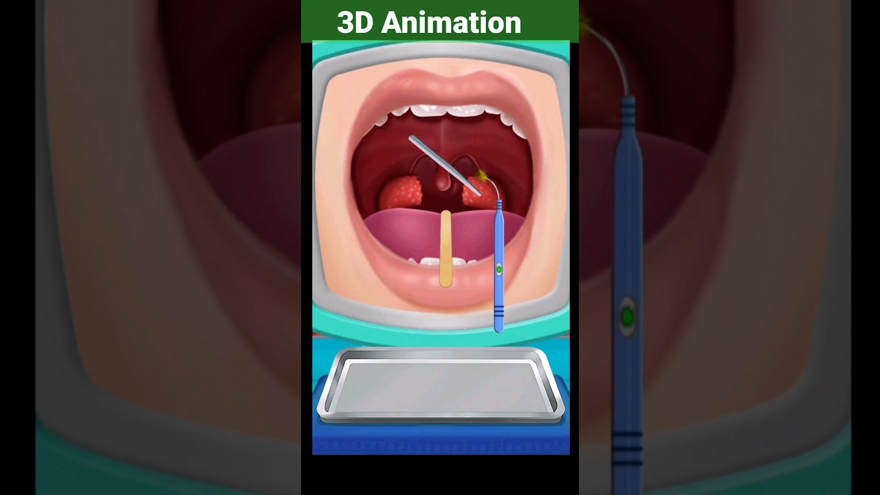 Patient is Here For Tonsils Removal 3D Animation | #shorts - YouTube