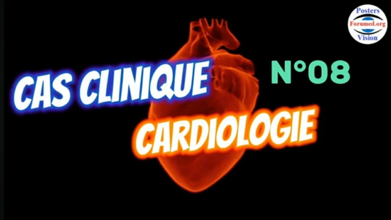 Cas Clinique de Cardiologie sur l'infarctus du myocarde QCM avec ...