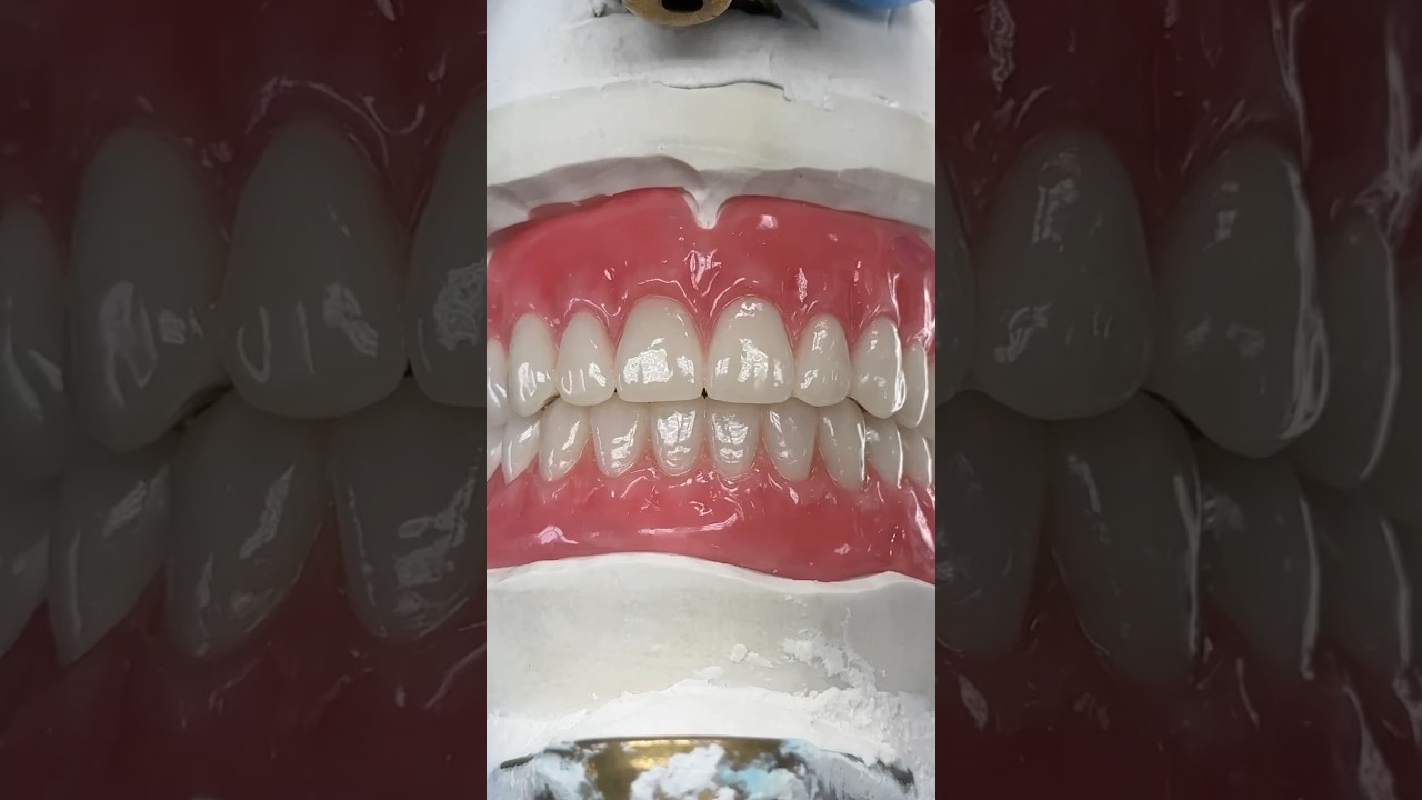 Try-In Set-Up #lsk121shorts #dentist #teeth - YouTube