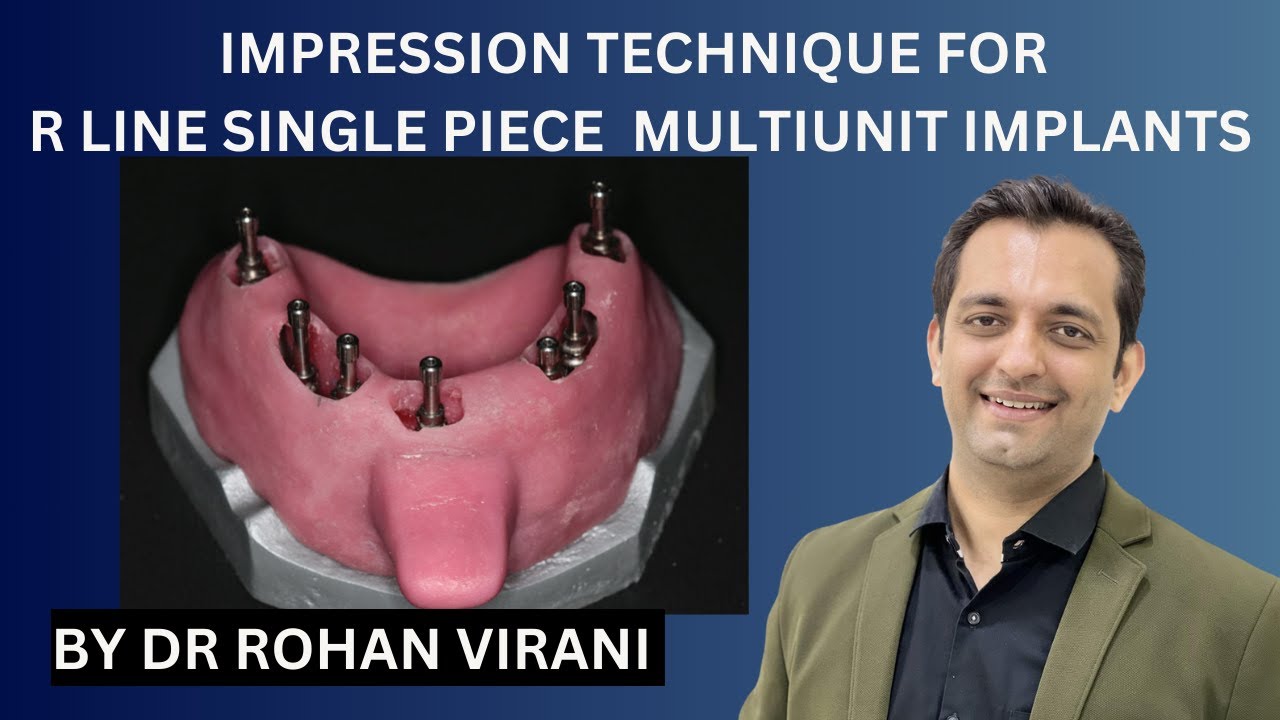 IMPRESSION TECHNIQUE FOR R LINE SINGLE PIECE MULTIUNIT IMPLANTS - BY DR ...