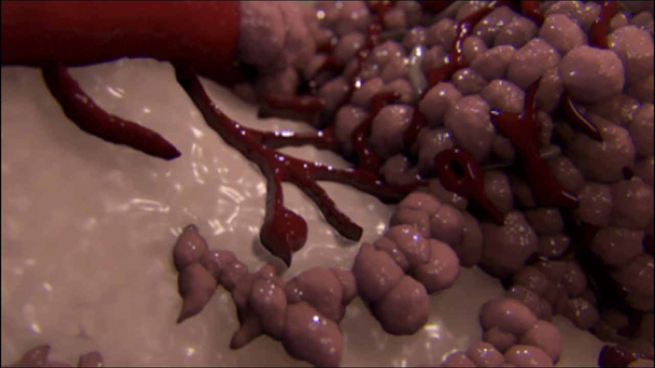 BCI Metastasis and Integrins Animation - GIFs - YouTube