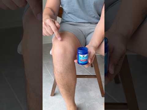 Wake up with zero knee pain using this paste #KneePainRelief #NaturalRemedy #DIY