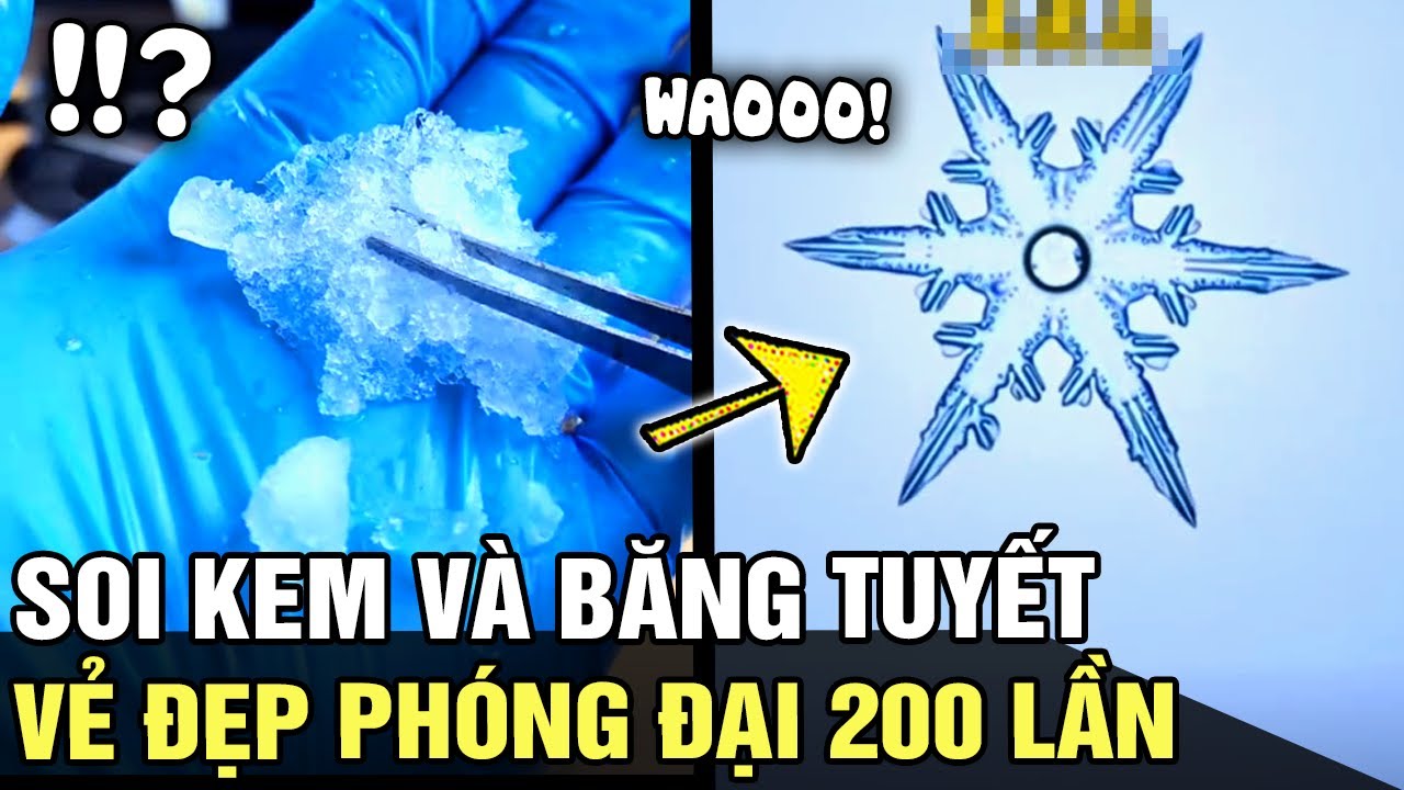 Soi KEM VÀ BĂNG ĐÁ dưới kính hiển vi: vẻ đẹp đến ngỡ ngàng dưới ĐỘ ...