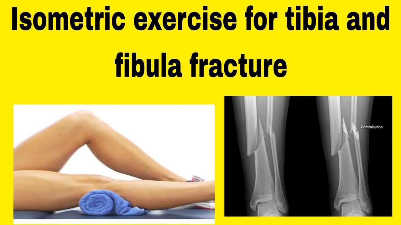 Isometric Exercise for Tibia and Fibula Fracture @geethamihi - YouTube