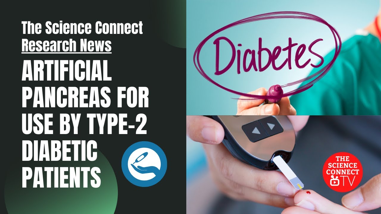 Artificial Pancreas' for Type 2 Diabetes Patients. #health#diabetes# ...