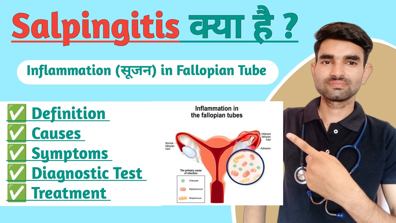 Salpingitis in Hindi | Causes, Symptoms And Treatment of Salpingitis ...