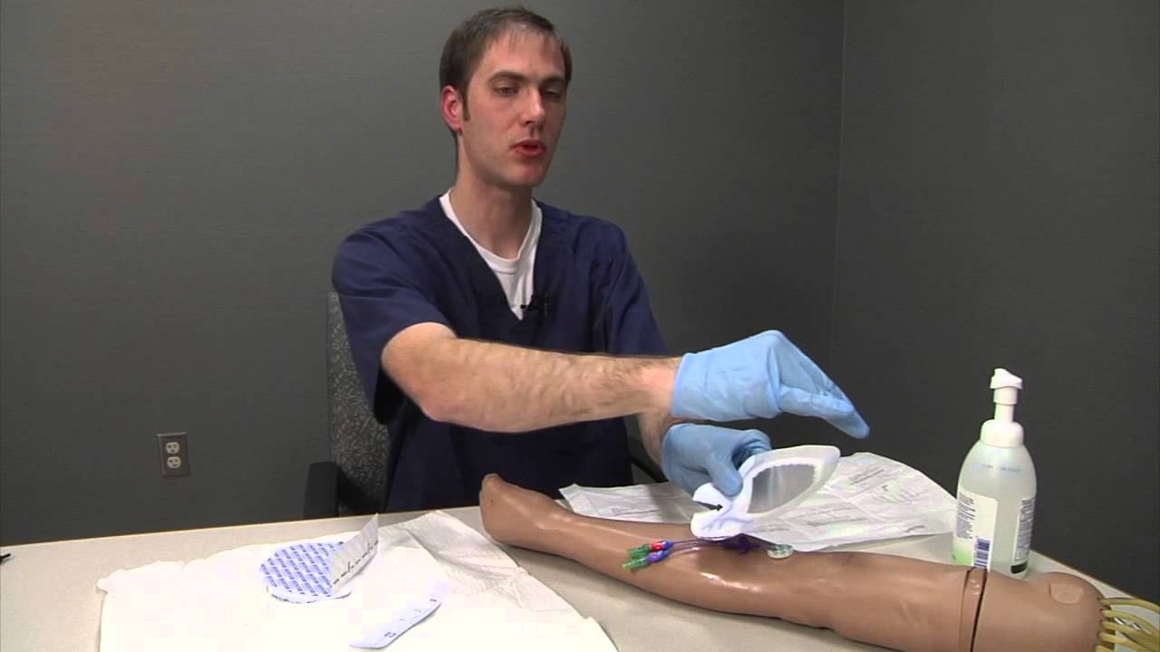 Sorbaview Oval Dressing Change - Mayo Clinic Patient Education - YouTube