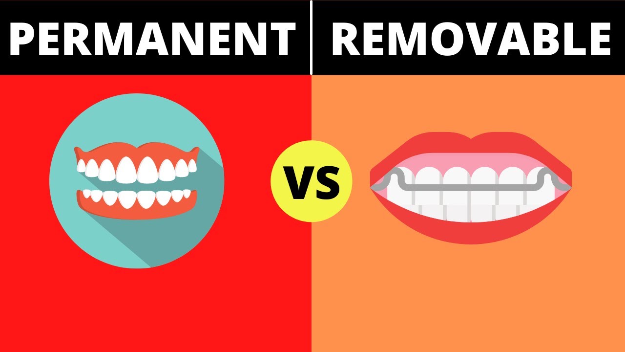 Permanent Retainers vs. Removable Retainers - YouTube