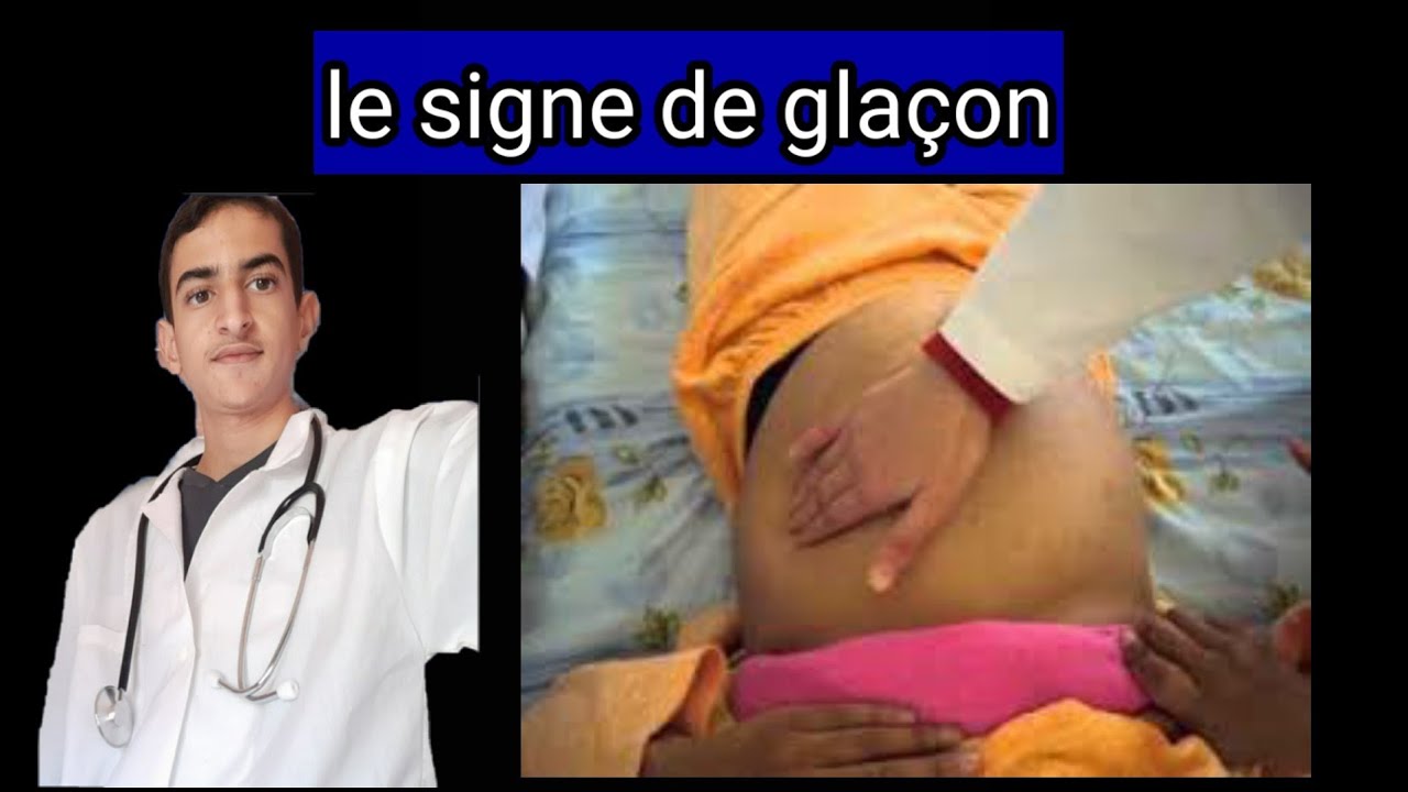 le signe de glaçon - YouTube