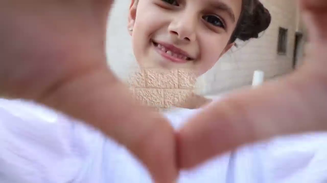 فيلم قصير متلازمة داون 💥 Youtube