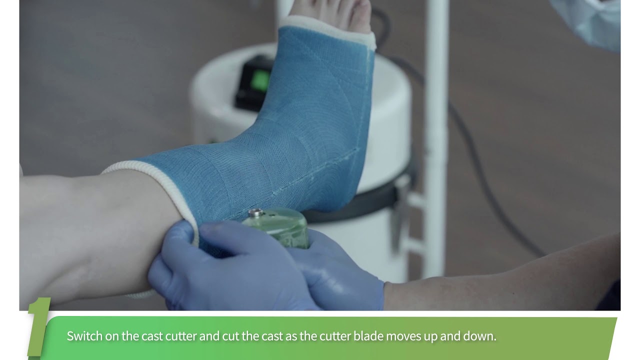 [Application] Cast Cutting (Short Leg Cast) - YouTube