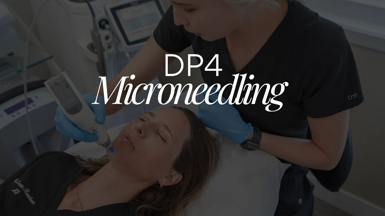 Microneedling DP4 #dp4 - YouTube