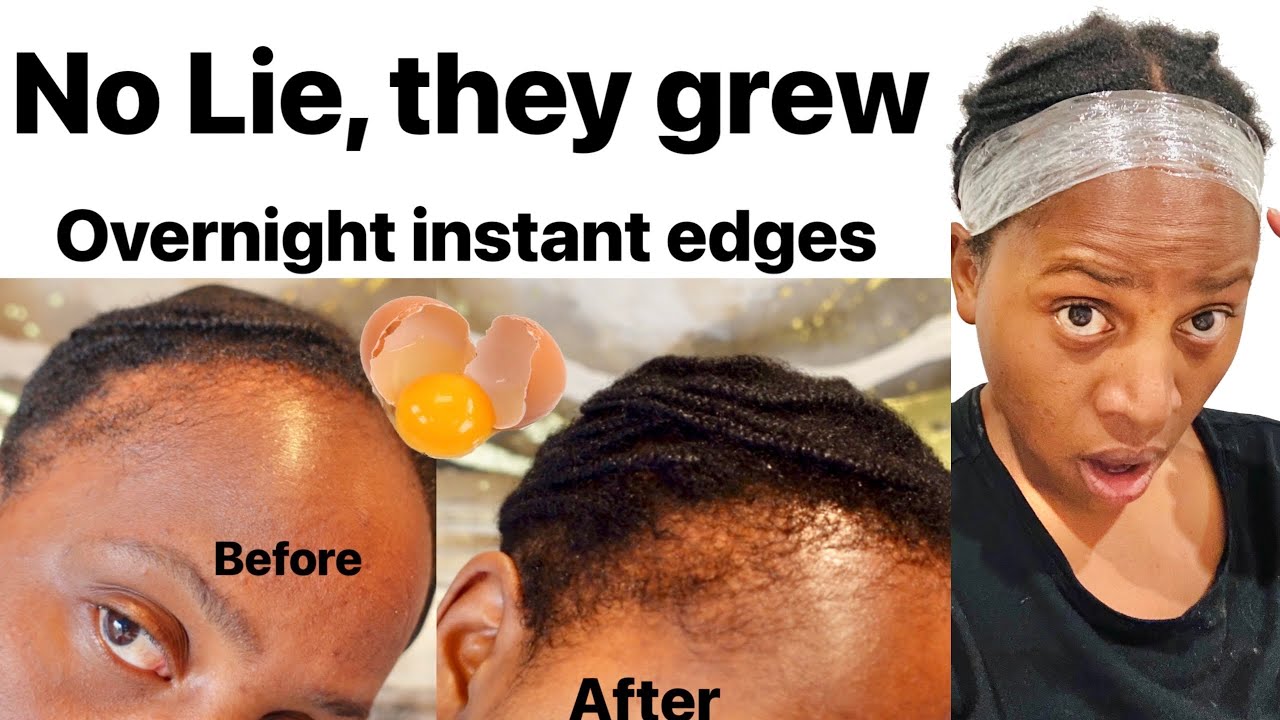 Overnight Instant Edges with only 2 ingredients! No lie they grew ...