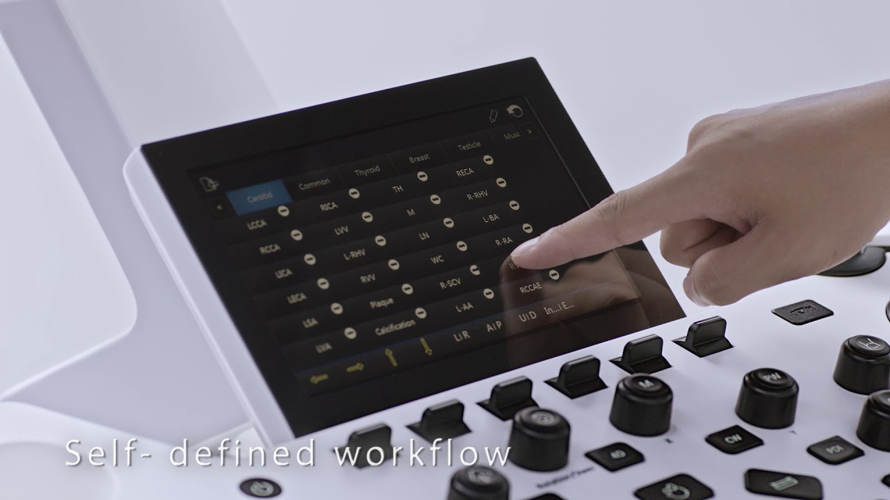 VINNO X1 Introduction - YouTube