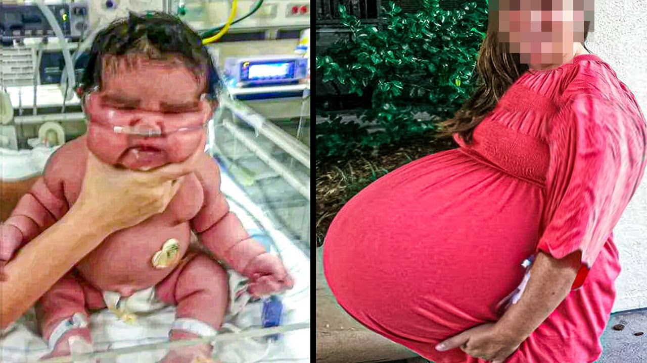 They thought she was carrying 8 babies. No one was prepared when it ...