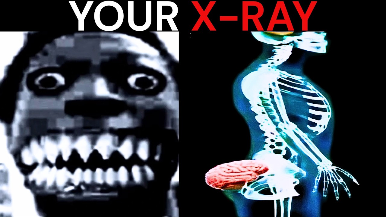 Mr Incredible Becoming Uncanny meme (Your X-ray) | 50+ phases - YouTube