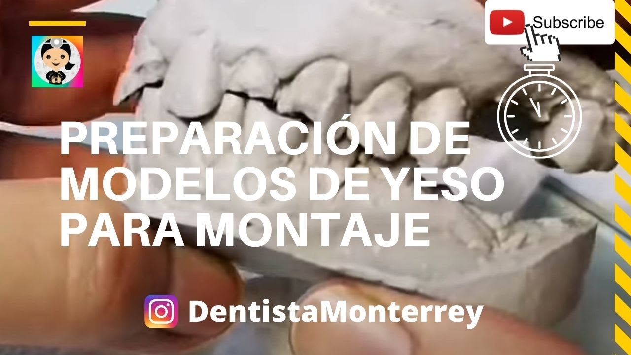 ⏭️ Preparación de Modelos de Yeso👅 Montaje en Articulador QuickVideo ...